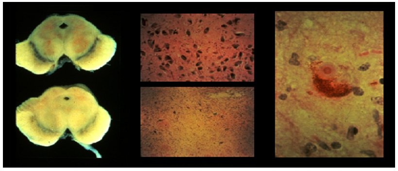 Aspects biologiques — Site des ressources d'ACCES pour enseigner les Sciences de la Vie et de la ...